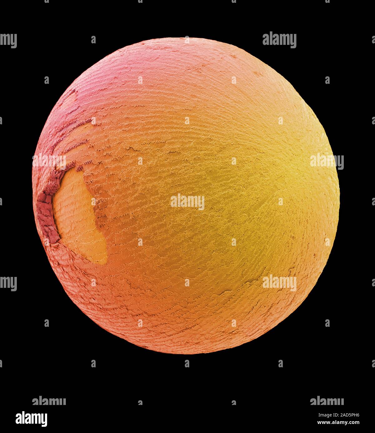 Eye lens. Coloured scanning electron micrograph (SEM) of a whole lens ...
