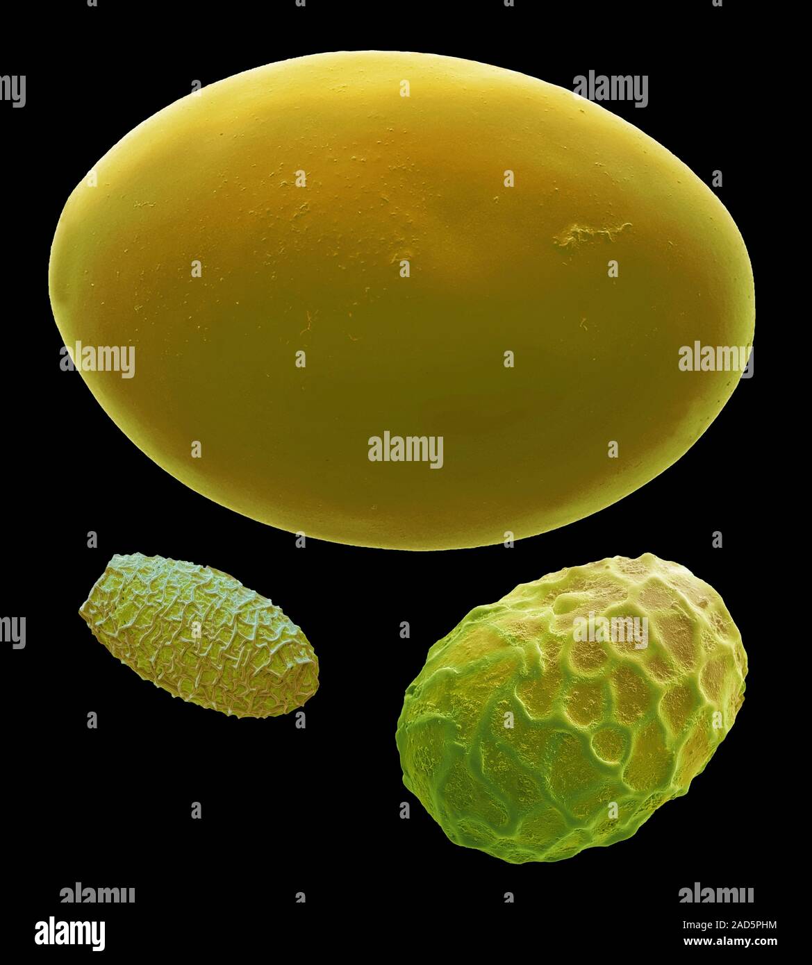 Eggs of a tapeworm, fluke and nematode. Coloured scanning electron ...