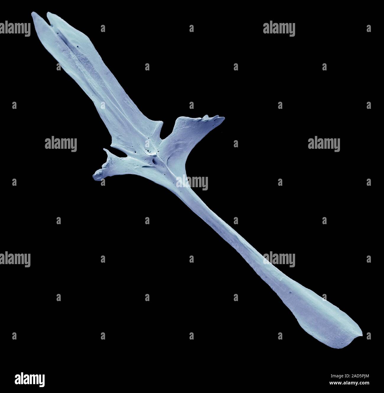 Coloured scanning electron micrograph (SEM) of the parasphenoid bone ...