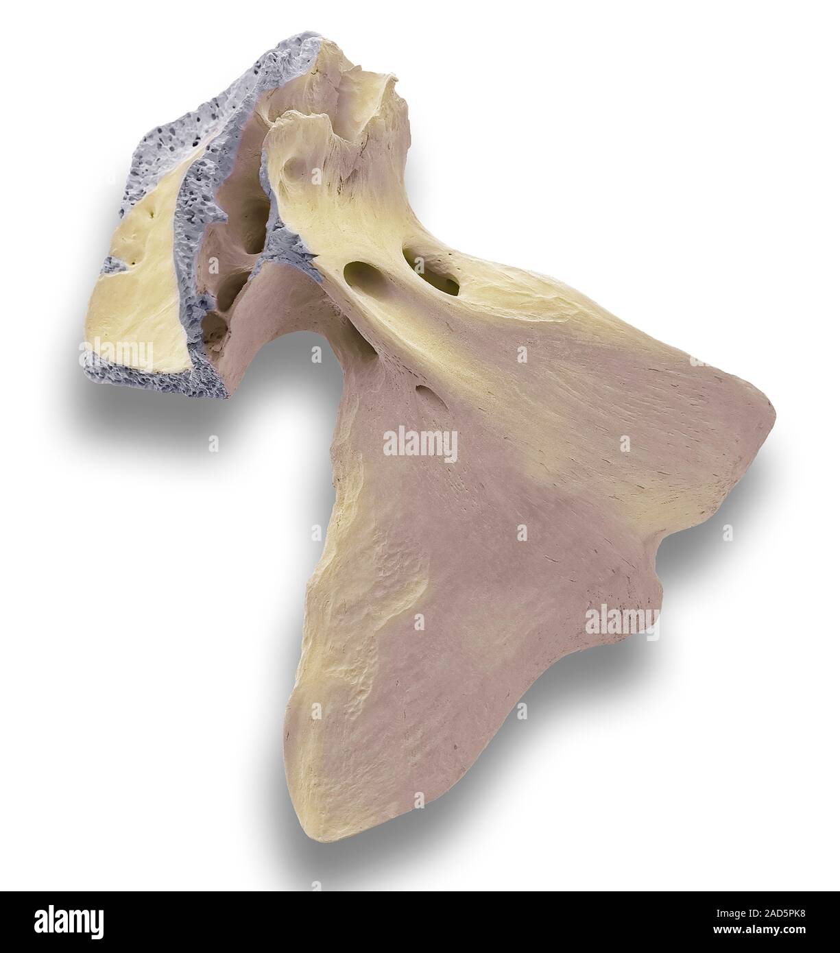 Coloured scanning electron micrograph (SEM) of the quadrate bone from a ...