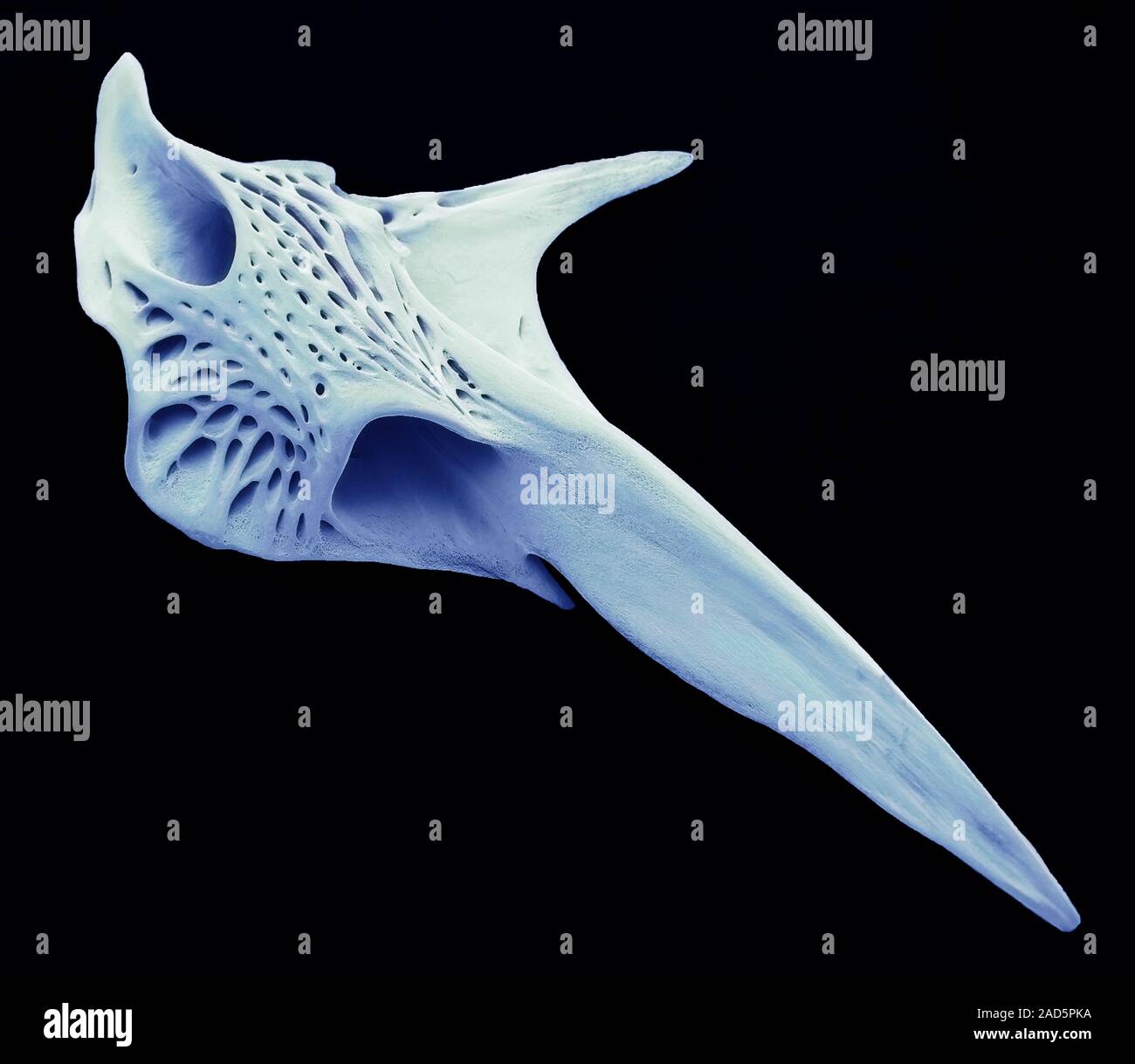 Coloured scanning electron micrograph (SEM) of the opercular bone from ...