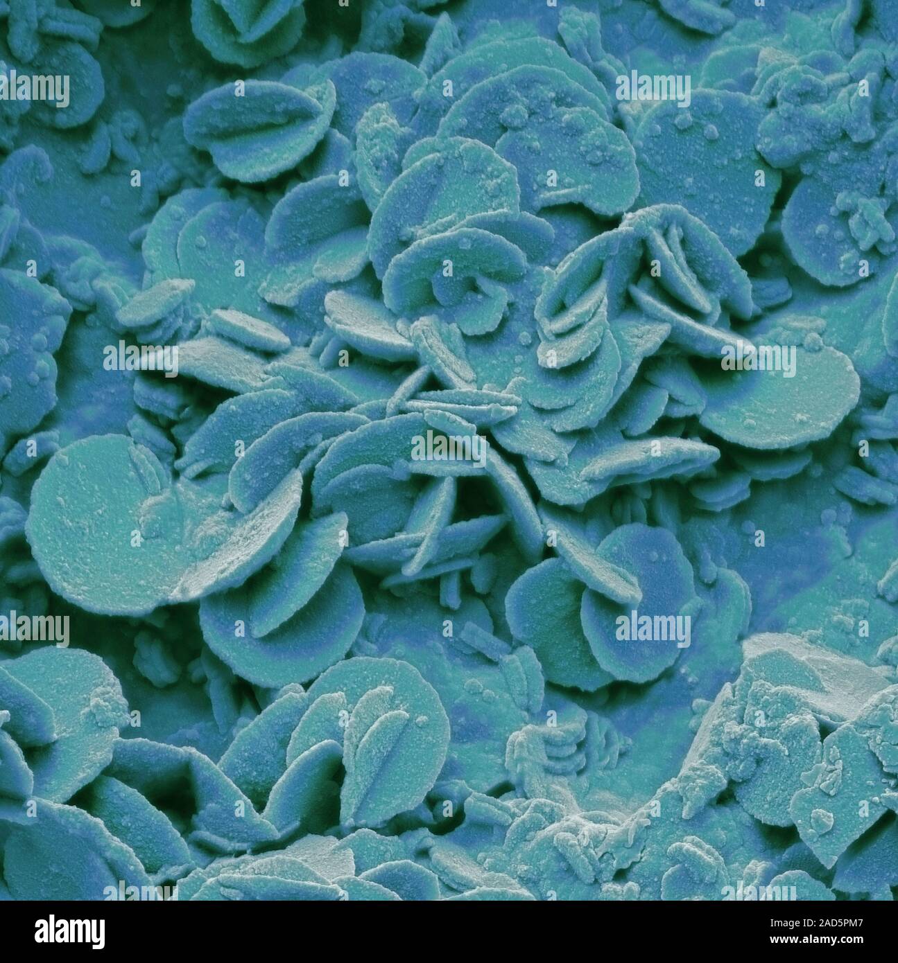 Rust. Coloured scanning electron micrograph (SEM) of rust on an metal ...