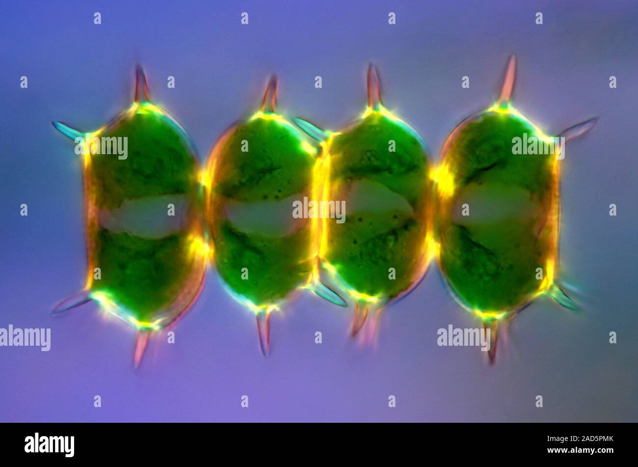 Xanthidium desmids. Polarised light micrograph of two Xanthidium ...