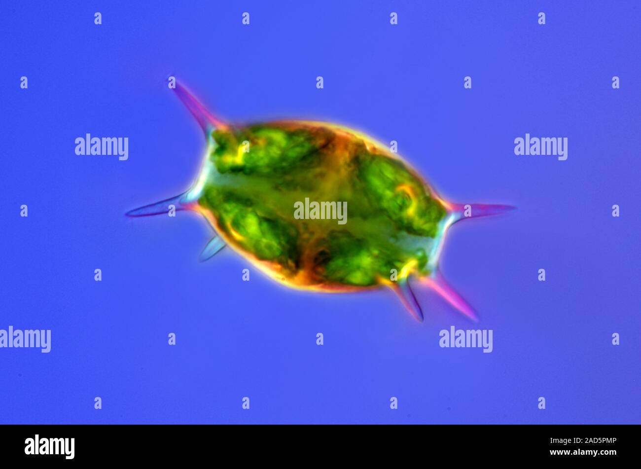 Xanthidium desmid. Polarised light micrograph of a Xanthidium ...