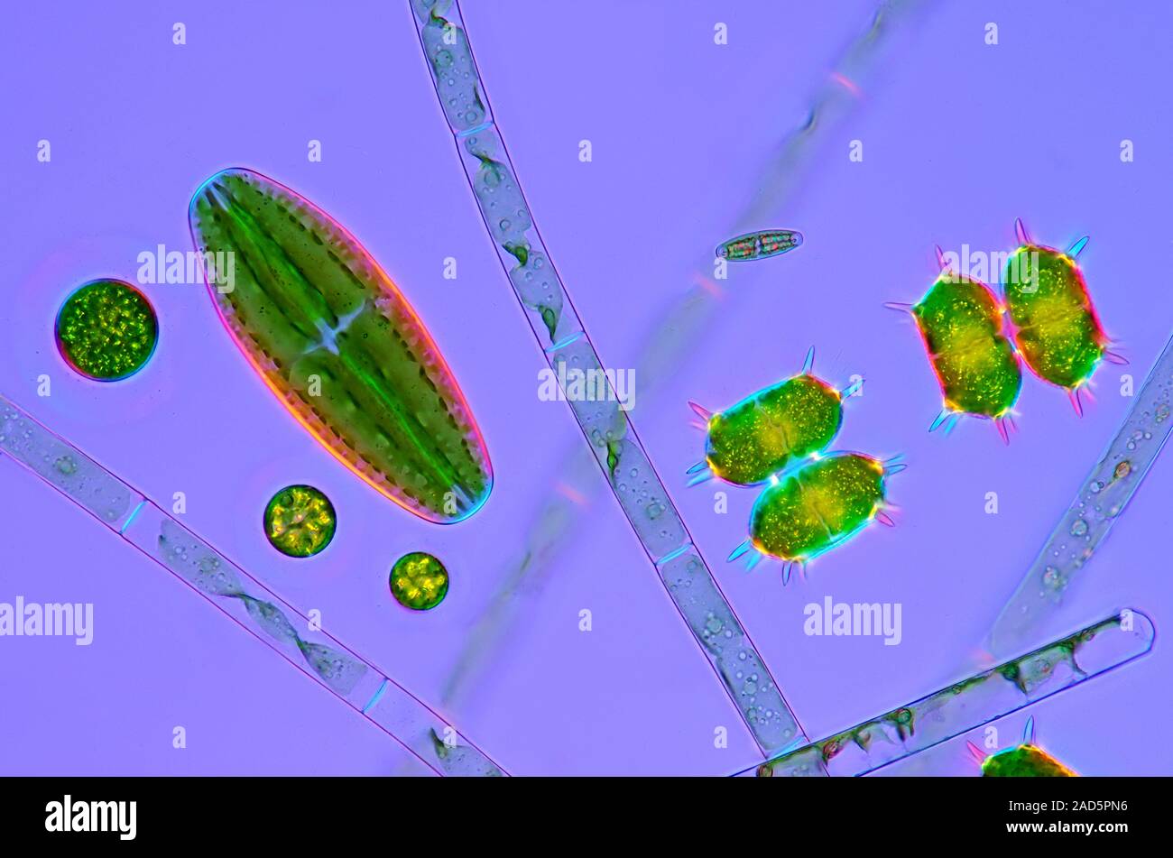Green algae. Polarised light micrograph of Netrium sp. (large, oval ...