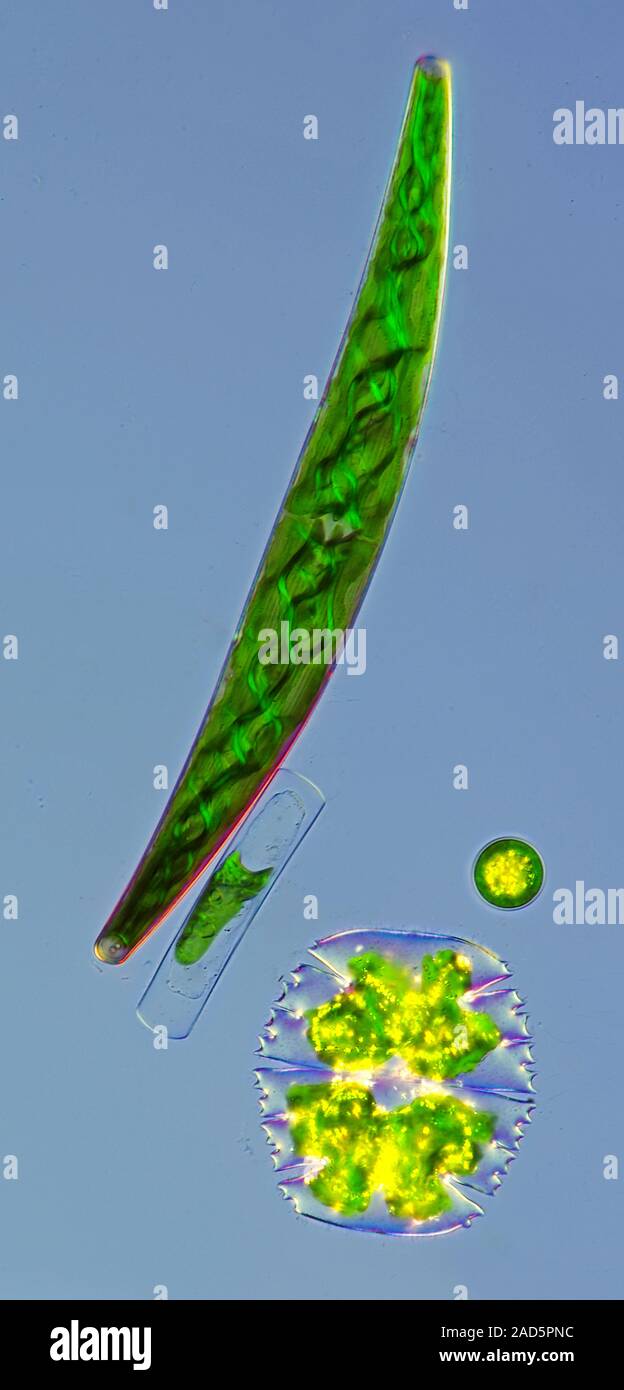 Desmids. Polarised light micrograph of Micrasterias truncata (round ...
