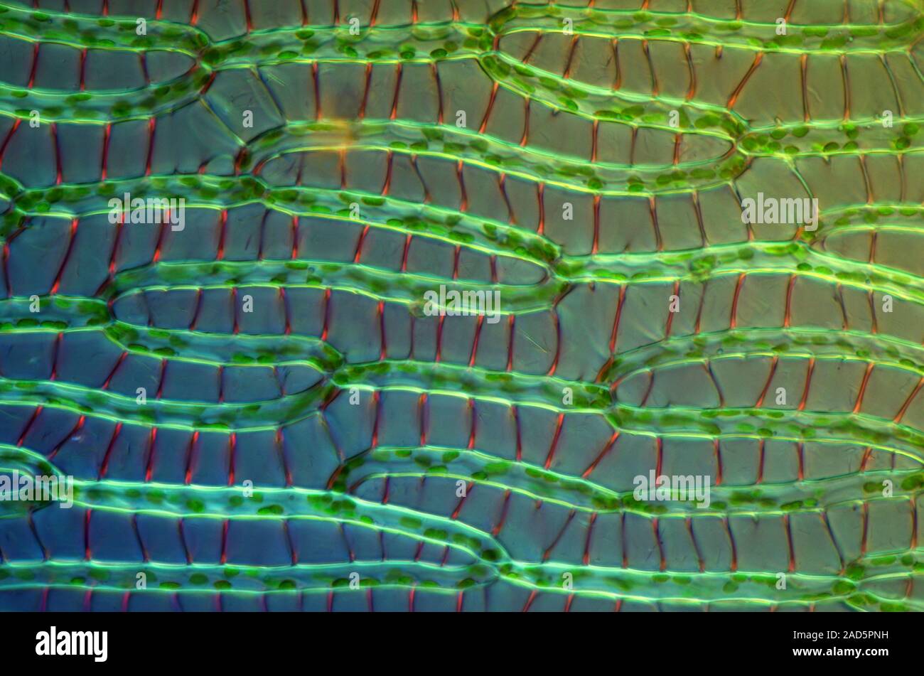 Sphagnum moss. Polarised light micrograph of a section through tissue ...