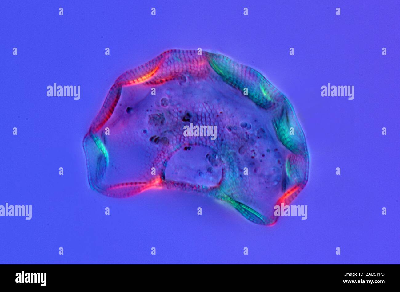 Testate amoeba. Polarised light micrograph of an Arcella sp. testate ...