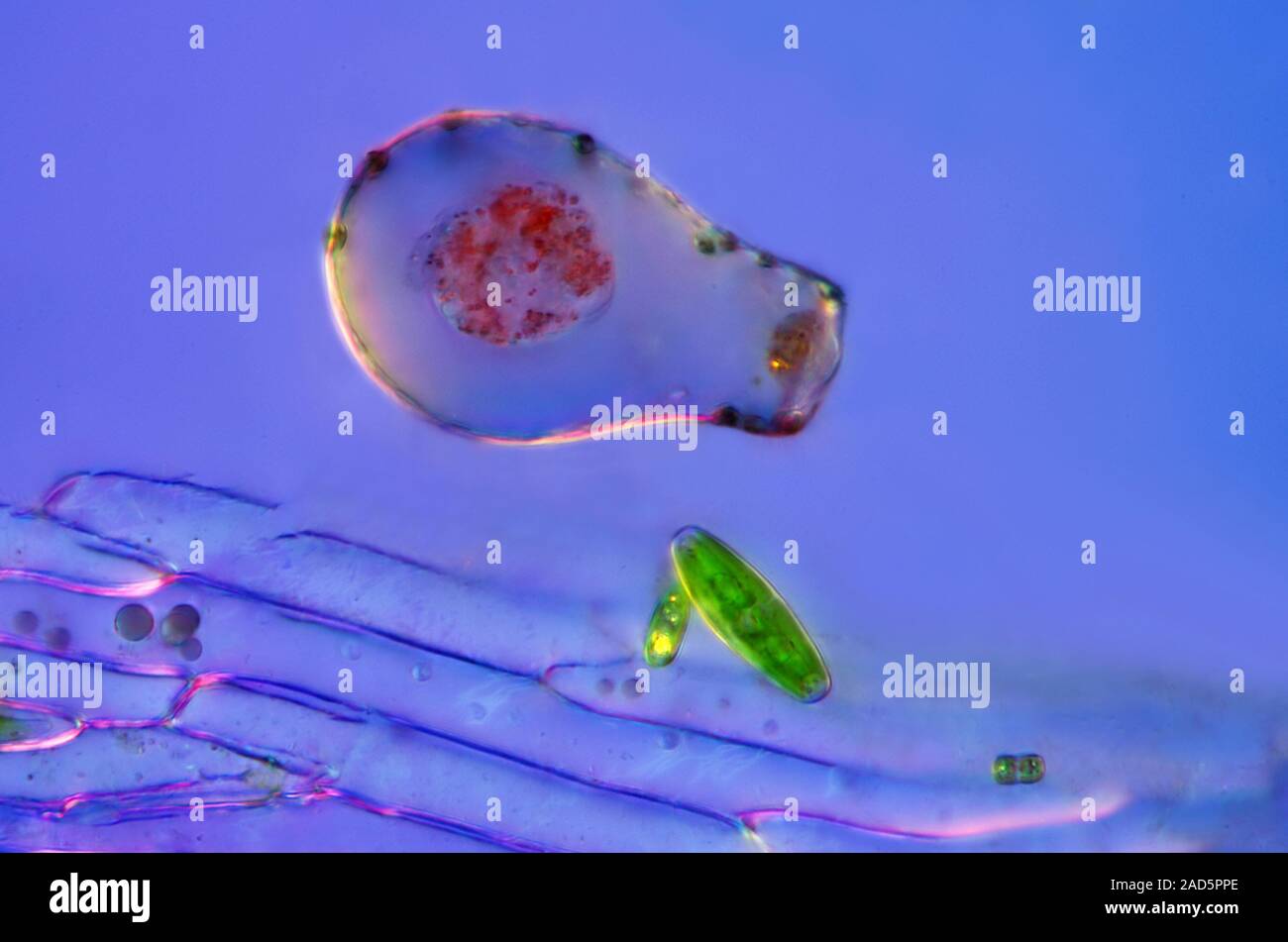 Testate amoeba and desmid. Polarised light micrograph of an Arcella sp ...
