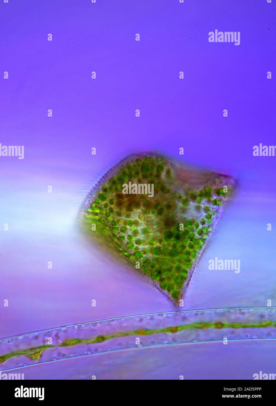 Stentor protozoan. Polarised light micrograph of a Stentor sp ...