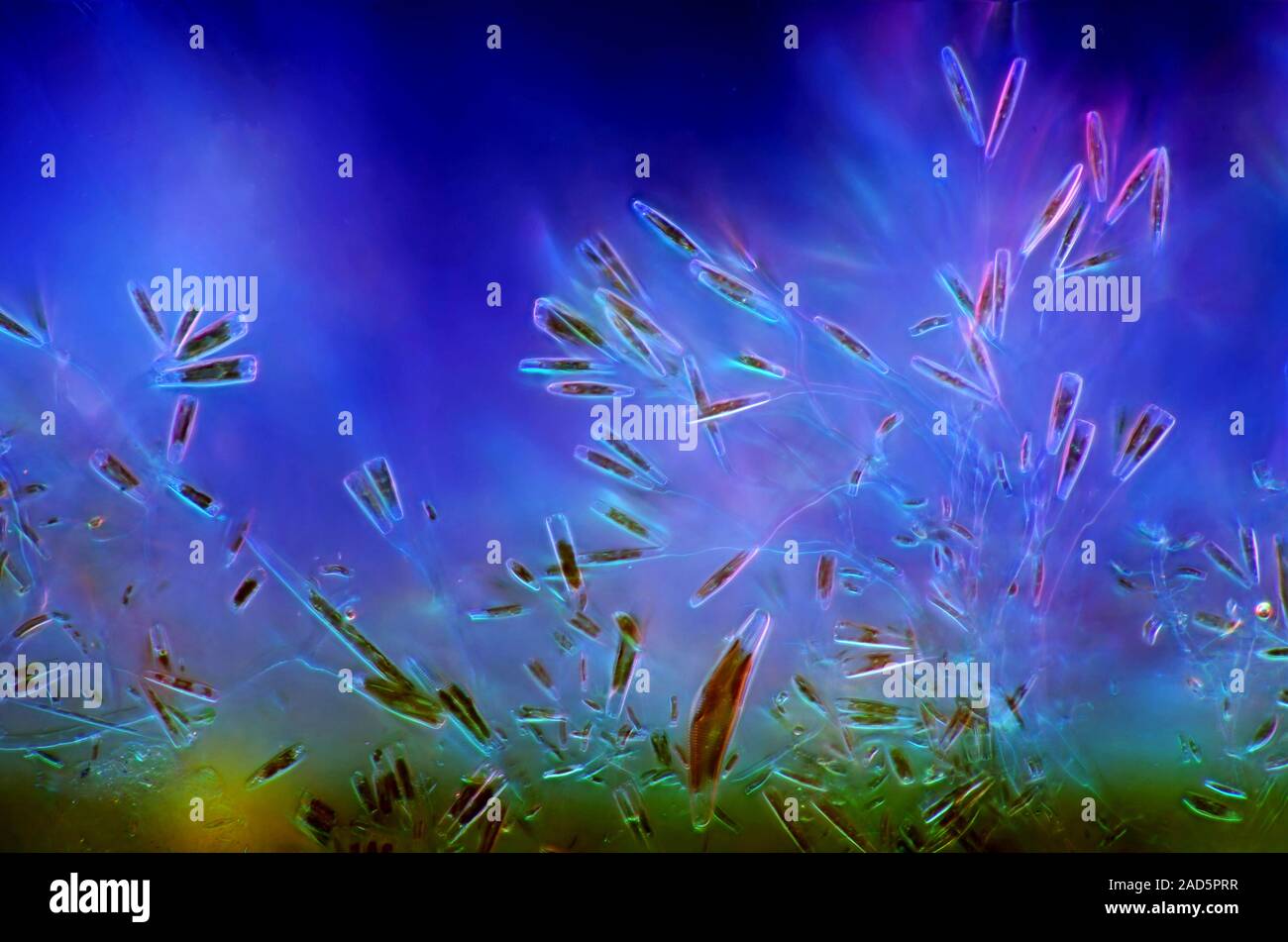 Diatoms. Darkfield illuminated polarised light micrograph of a group of ...