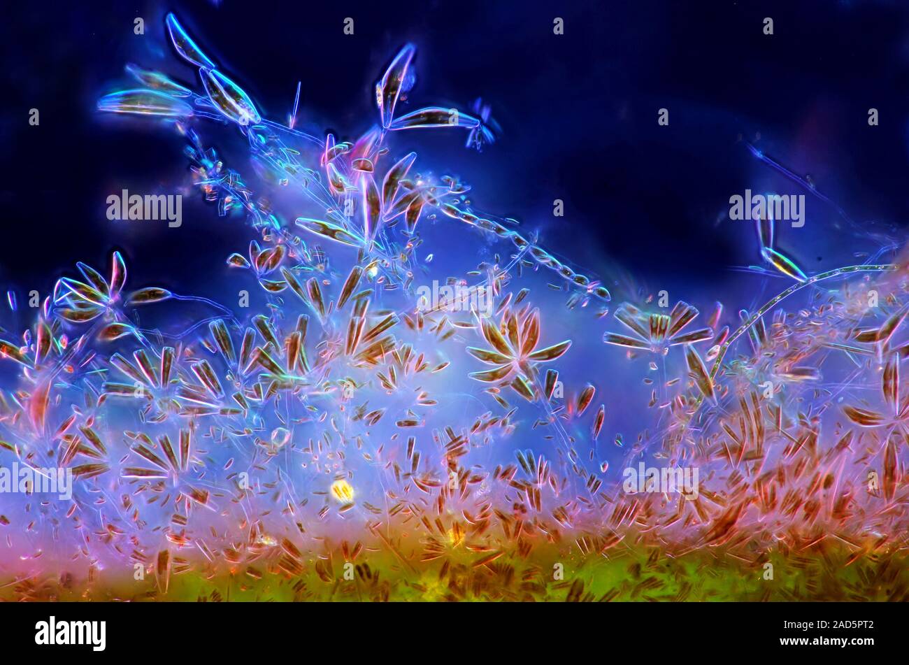 Diatoms. Darkfield illuminated polarised light micrograph of a group of ...