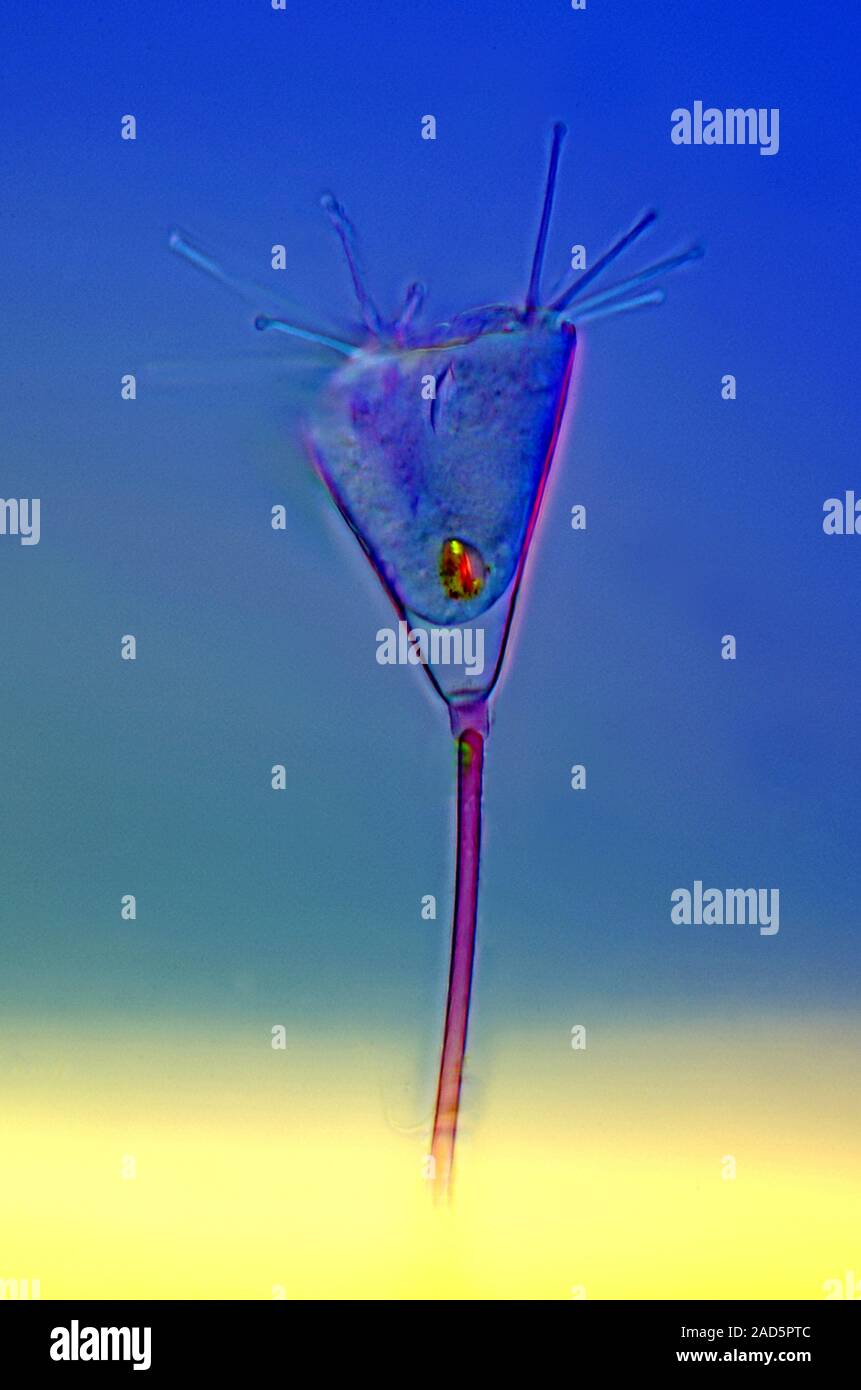 Suctorian protozoan. Polarised light micrograph of a suctorian ciliate ...