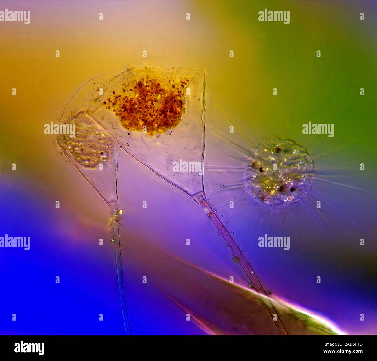 Ciliate protozoa. Polarised light micrograph of two suctorian ciliate ...