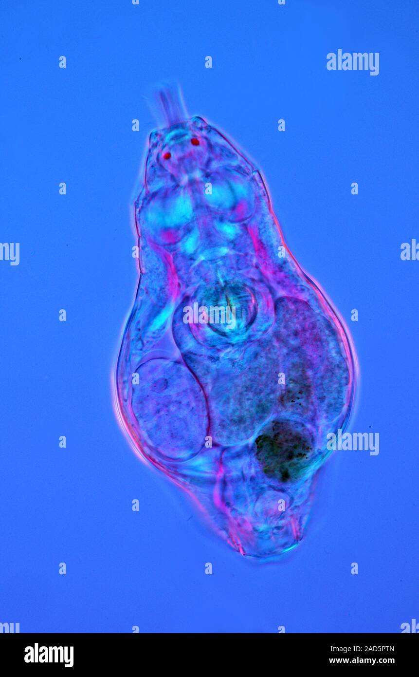 Rotifer. Polarised light micrograph of a rotifer (phylum Rotifera ...