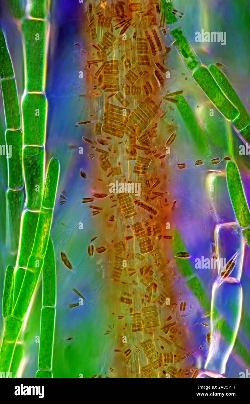 Diatoms and Cladophora algae. Polarised light micrograph of various ...