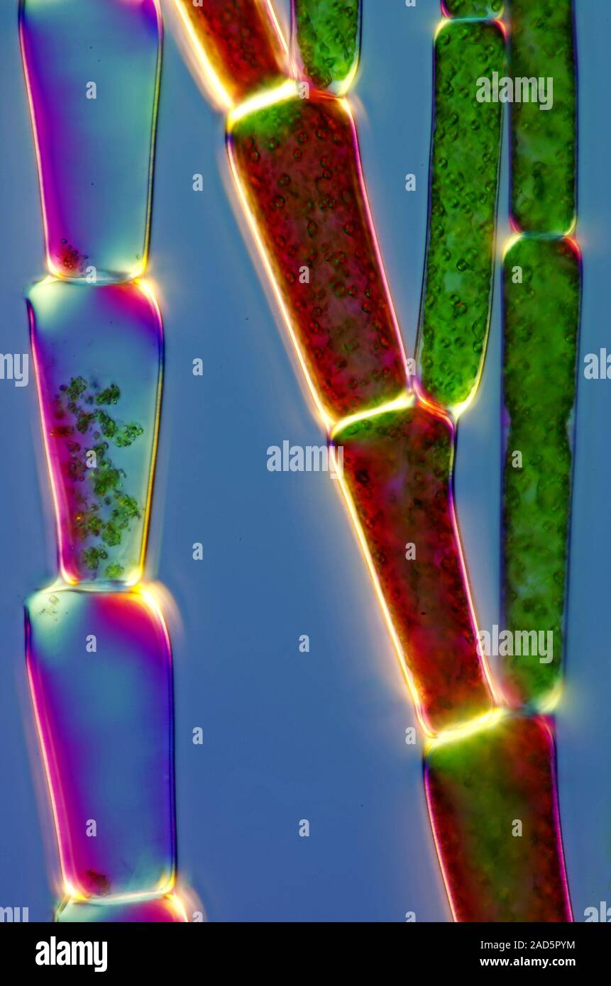 Cladophora green algae. Polarised light micrograph of filaments of ...
