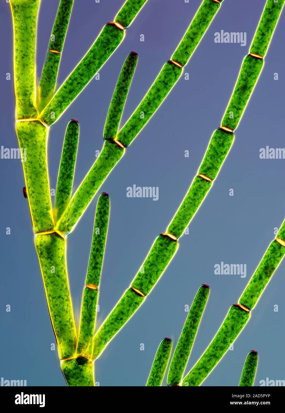 Cladophora green algae. Polarised light micrograph of filaments of ...