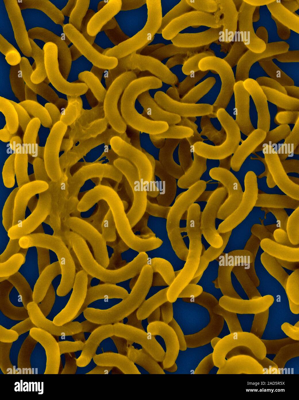 Coloured scanning electron micrograph (SEM) of Vibrio cholerae bacteria ...