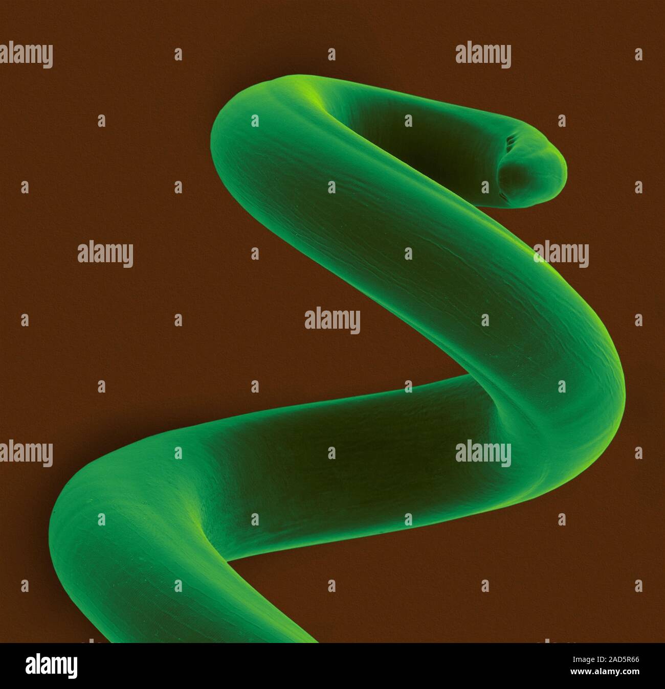 Coloured scanning electron micrograph (SEM) of a dog lungworm ...