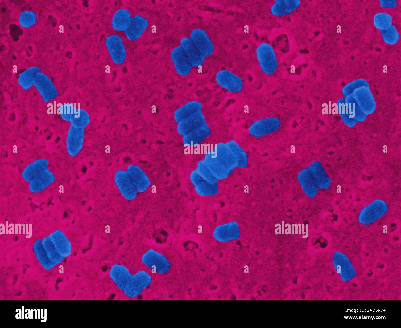 Composite coloured scanning electron micrograph (SEM) of rhabdovirus ...