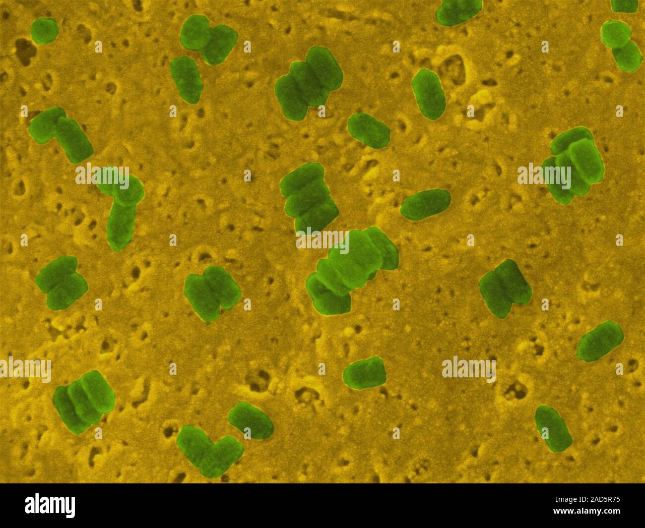 Composite coloured scanning electron micrograph (SEM) of rhabdovirus ...