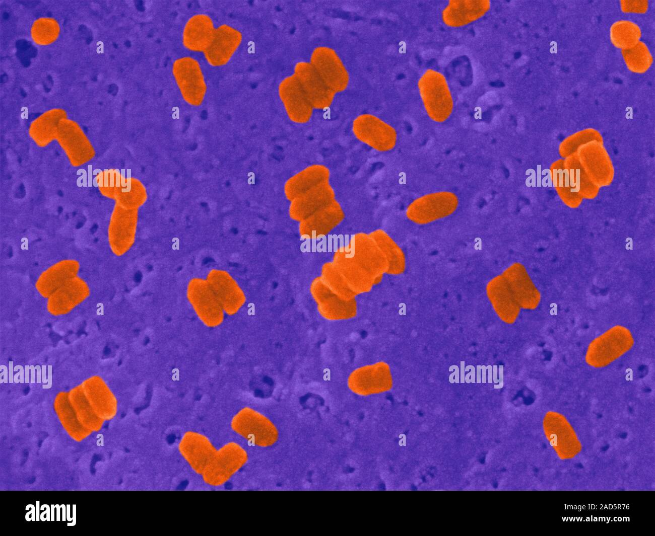 Composite coloured scanning electron micrograph (SEM) of rhabdovirus ...