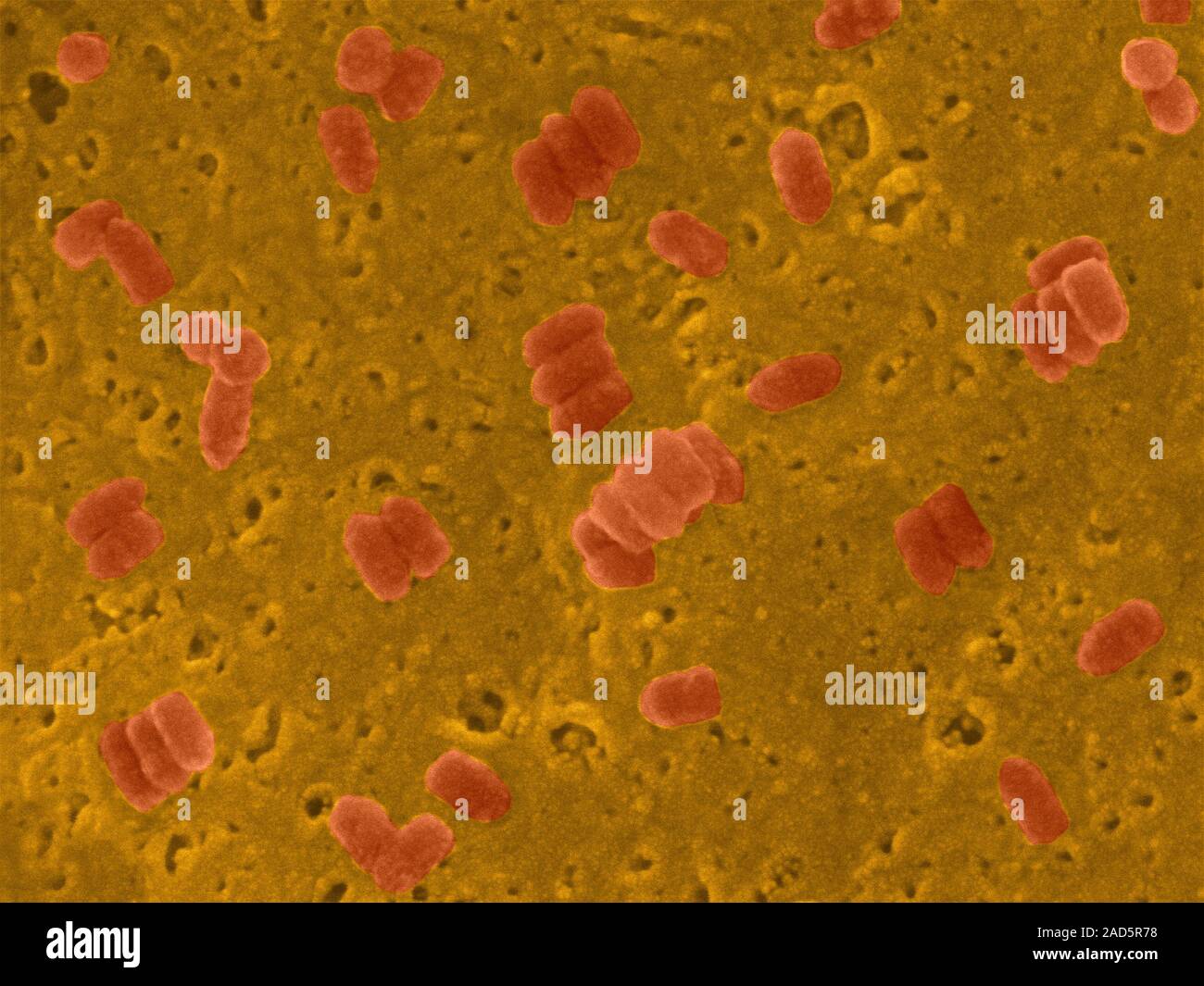 Composite coloured scanning electron micrograph (SEM) of rhabdovirus ...