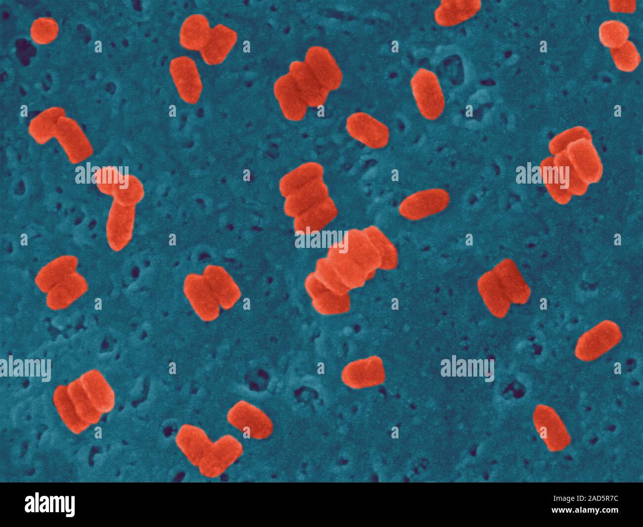 Composite coloured scanning electron micrograph (SEM) of rhabdovirus ...
