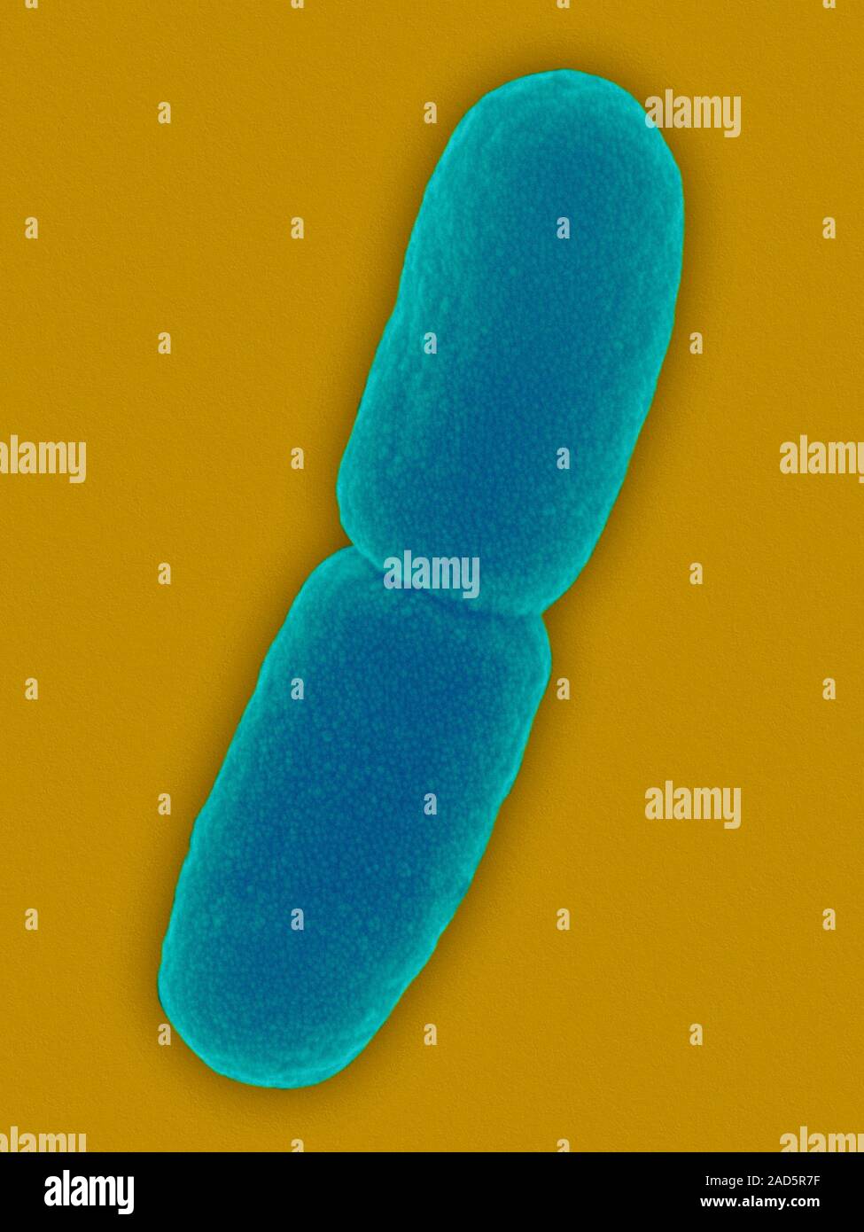 Coloured Scanning Electron Micrograph Sem Of Pseudomonas Aeruginosa Bacteria Dividing This Is