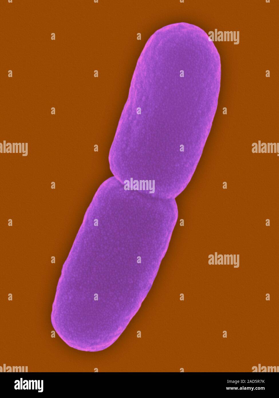 Coloured scanning electron micrograph (SEM) of Pseudomonas aeruginosa ...