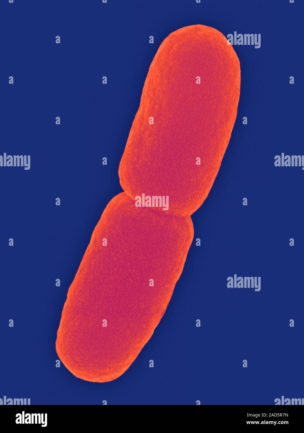 Coloured scanning electron micrograph (SEM) of Pseudomonas aeruginosa ...