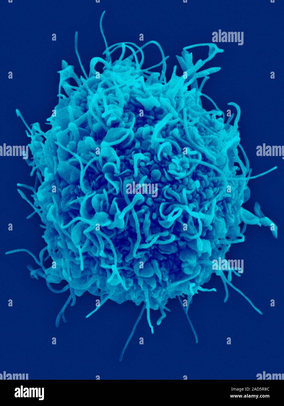 Coloured scanning electron micrograph (SEM) of human dendritic cells ...