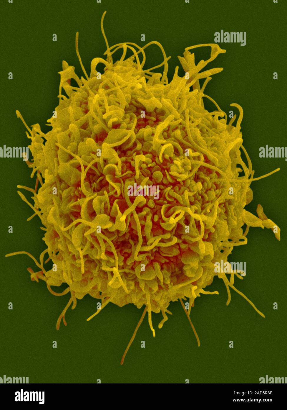 Coloured scanning electron micrograph (SEM) of human dendritic cells ...