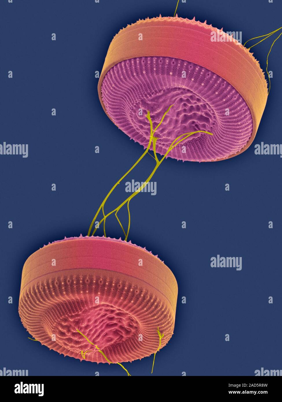 Coloured scanning electron micrograph (SEM) of a diatom (Cyclotella sp ...
