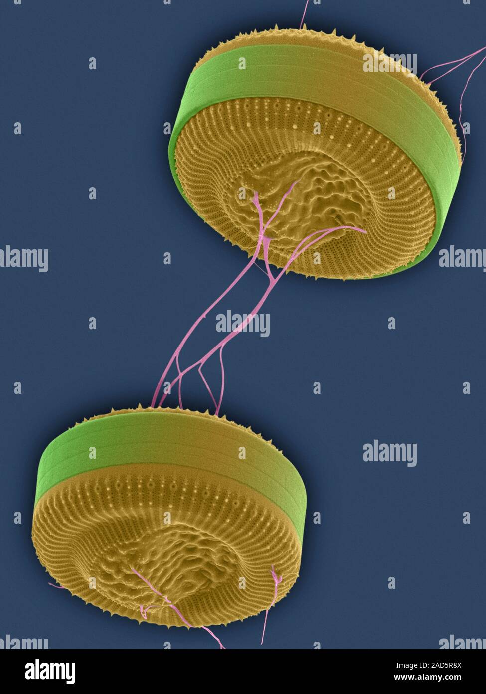 Coloured scanning electron micrograph (SEM) of a diatom (Cyclotella sp ...