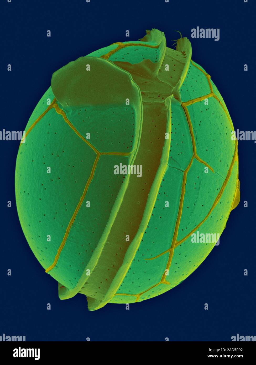 Coloured scanning electron micrograph (SEM) of a lateral girdle view ...