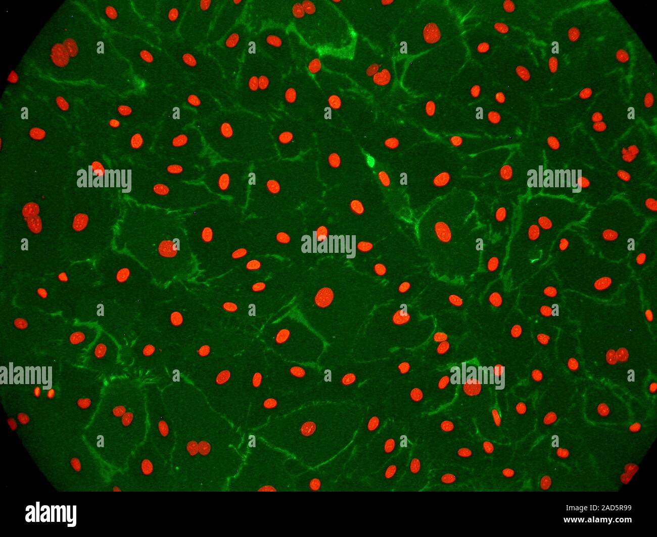 Dermal endothelial cells, fluorescence light micrograph. This tissue ...