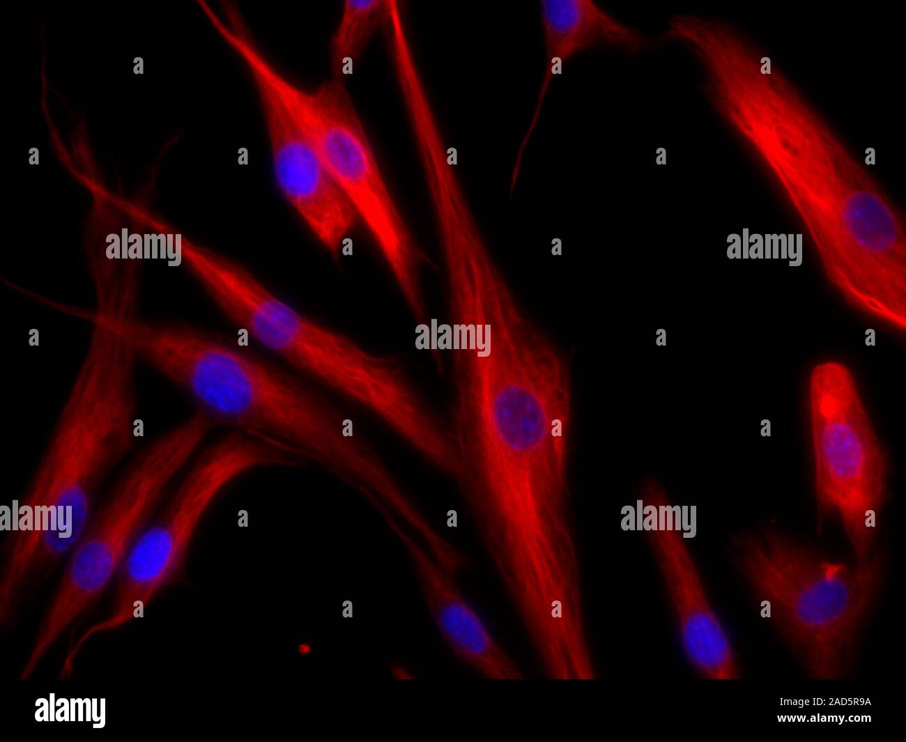 Dermal fibroblast cells, fluorescence light micrograph. Fibroblasts are ...