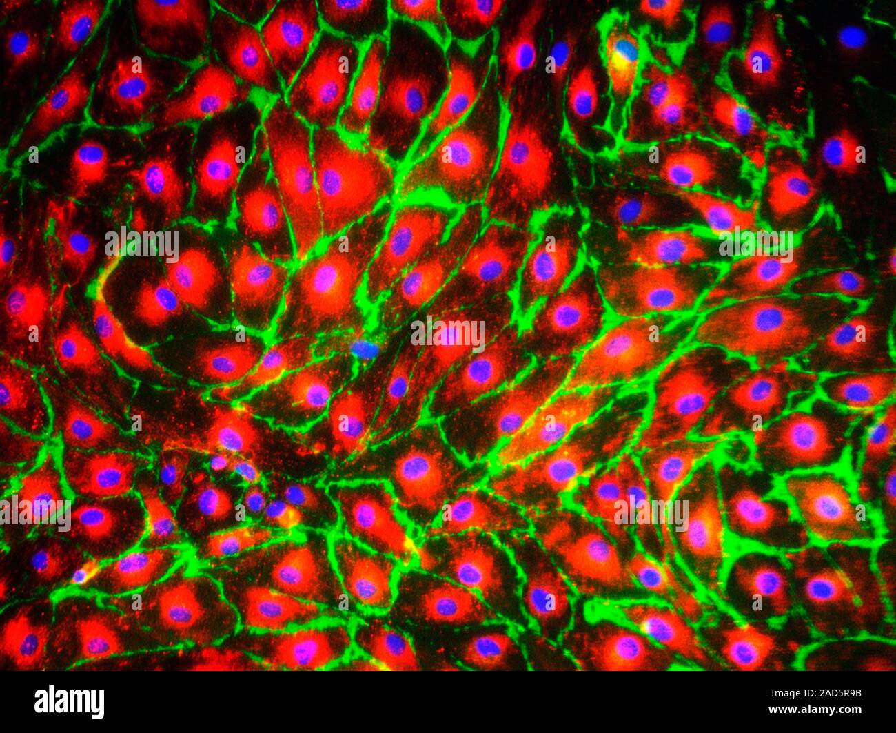 Dermal endothelial cells, fluorescence light micrograph. This tissue ...