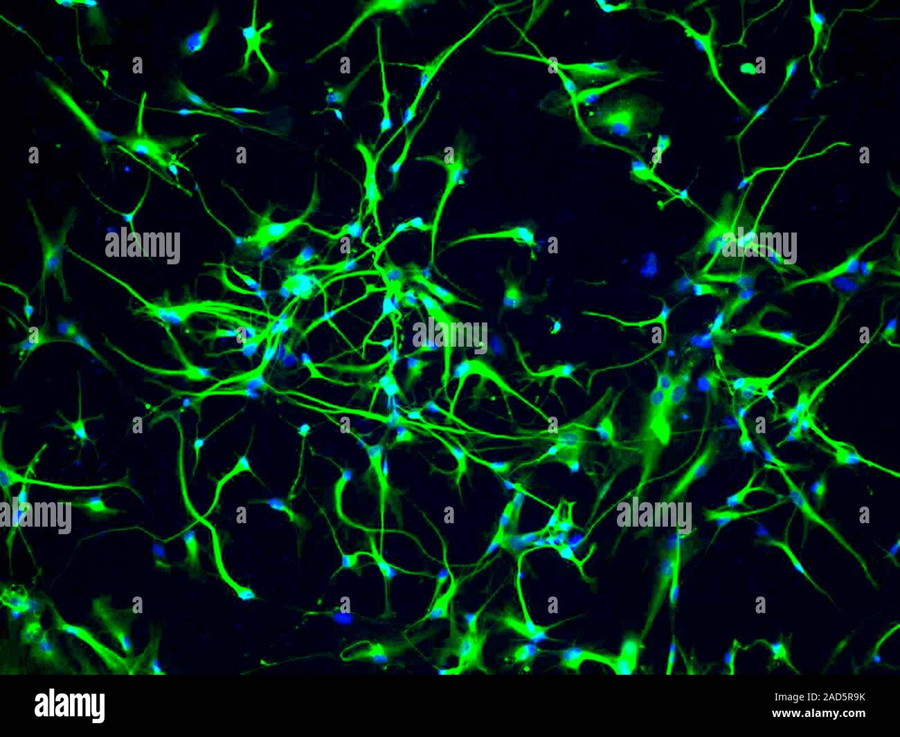 Neural stem cells, fluorescence light micrograph. These neural stem ...