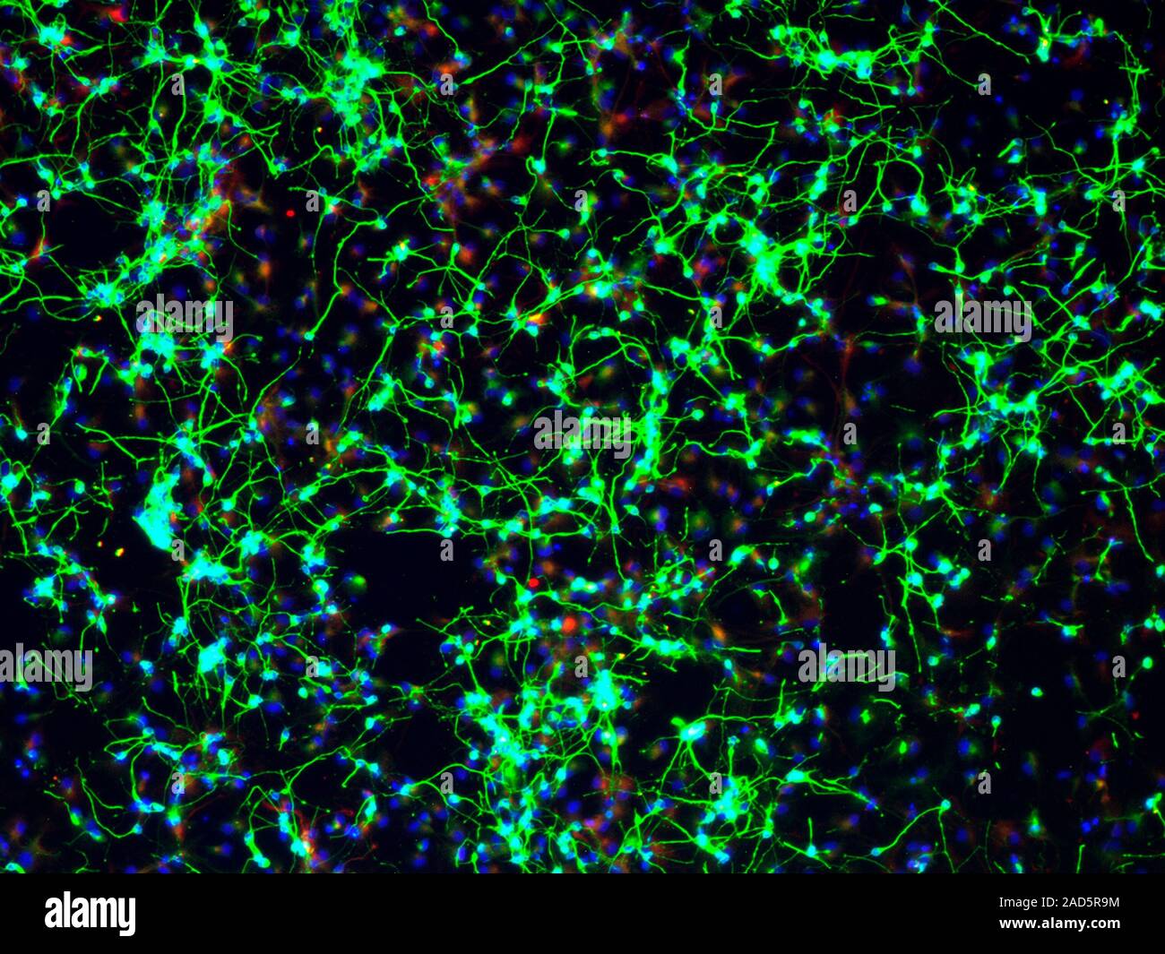 Neural stem cells, fluorescence light micrograph. These neural stem ...