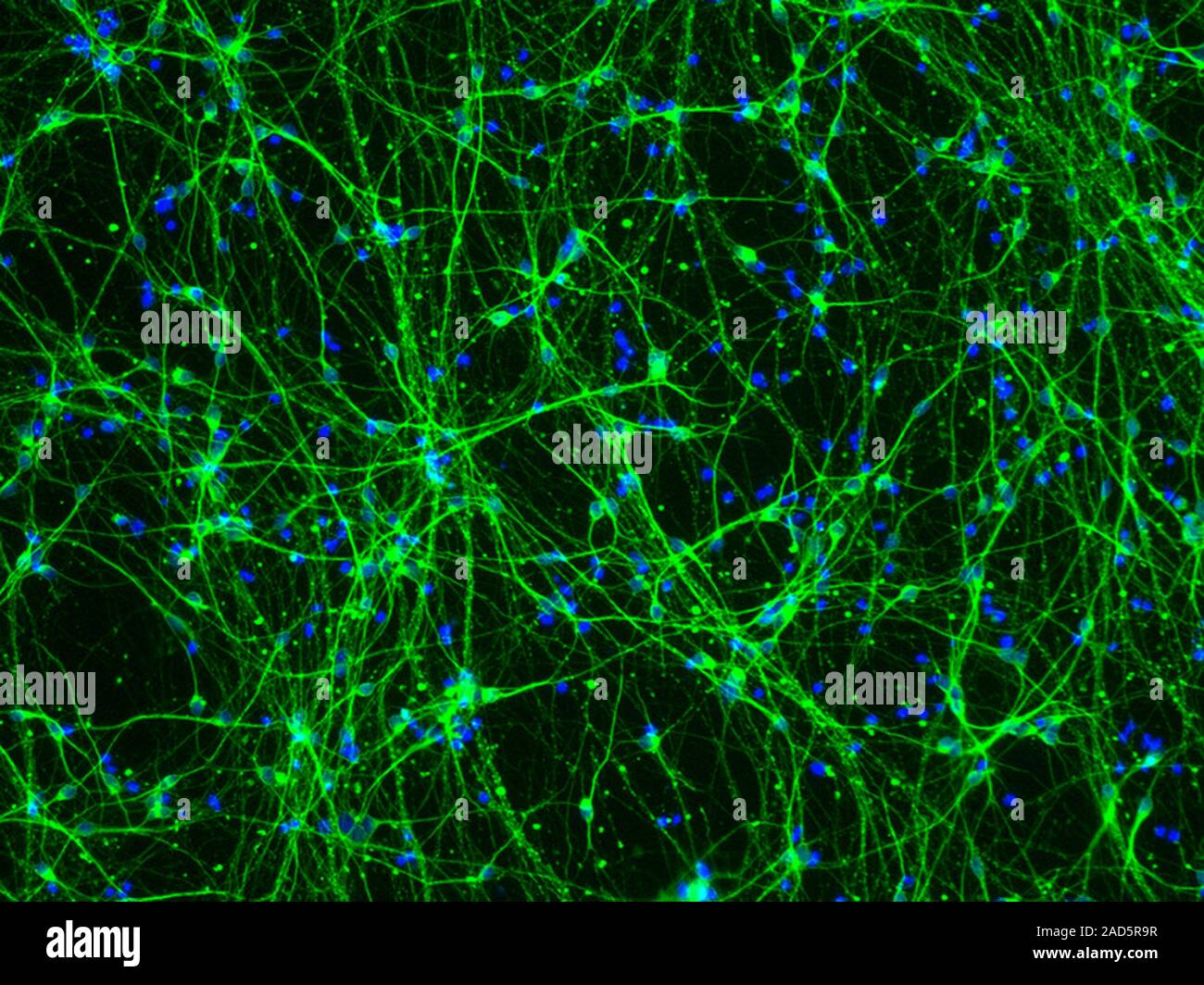 Neurons from stem cells, fluorescence light micrograph. Stem cells are ...
