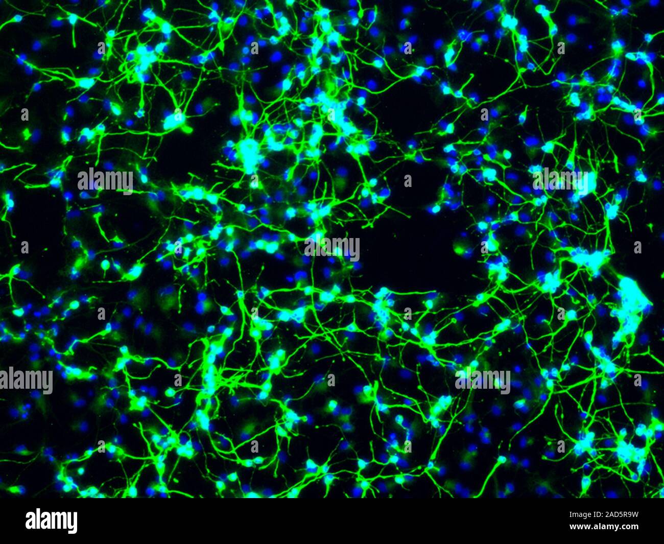 Neurons from stem cells, fluorescence light micrograph. Stem cells are ...