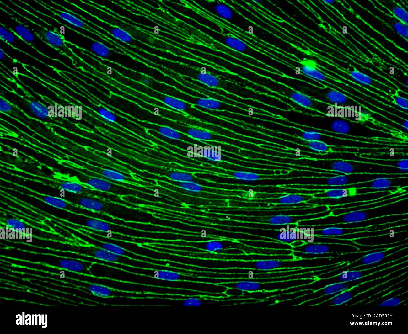 Brain endothelial cells, fluorescence light micrograph. This tissue ...