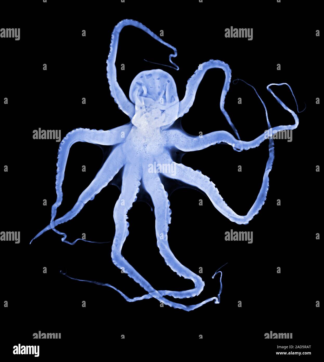 Octopus, coloured X-ray Stock Photo - Alamy