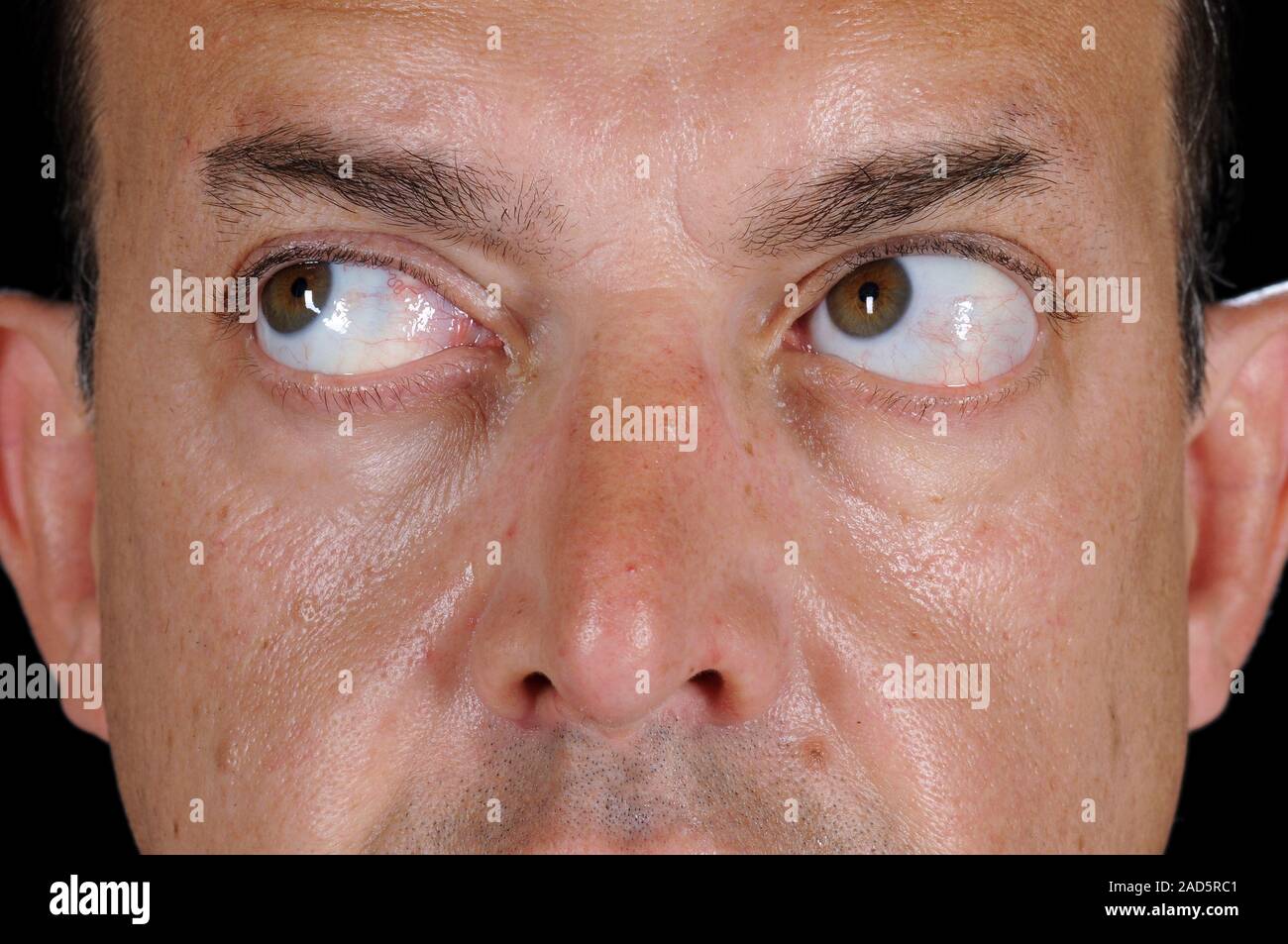 Positions of gaze, looking up and right. 50-year-old man demonstrating ...