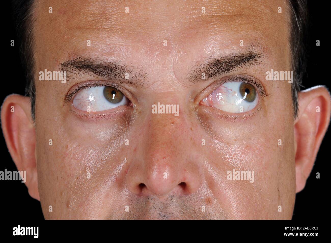 Positions of gaze, looking up and left. 50-year-old man demonstrating ...