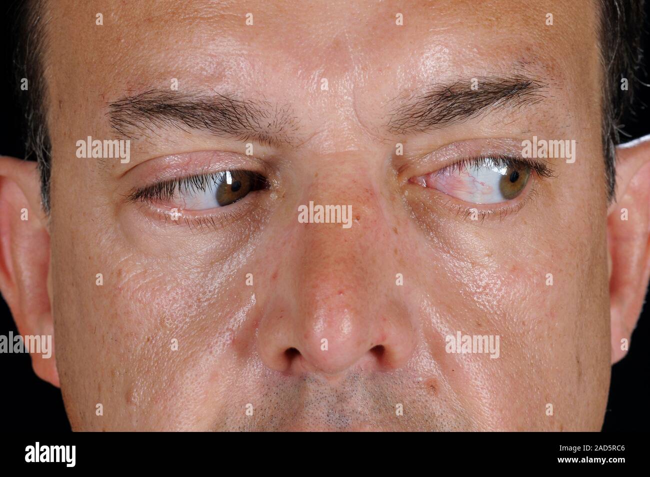 Positions of gaze, looking left. 50-year-old man demonstrating one of ...