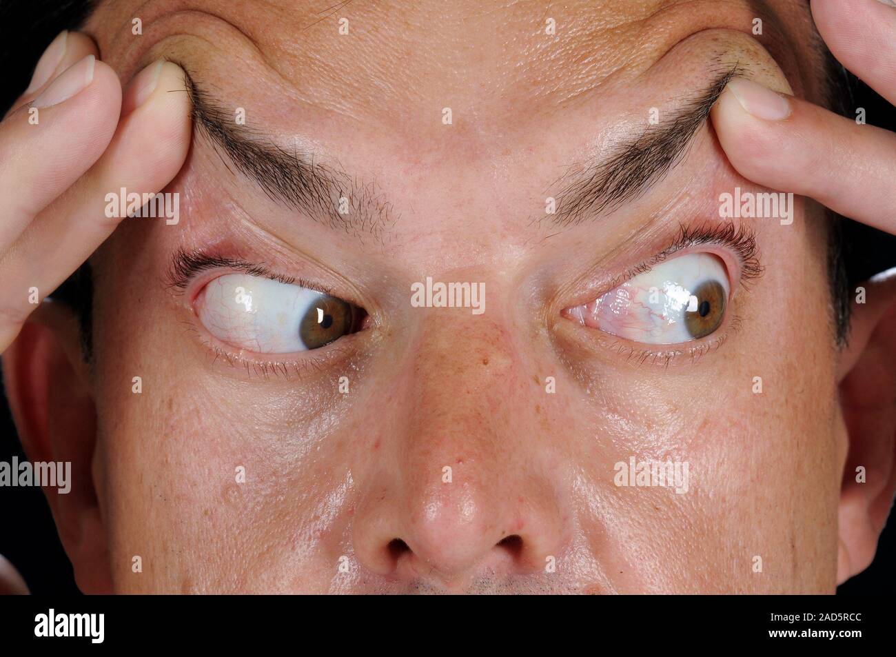 Positions of gaze, looking down and left. 50-year-old man demonstrating ...